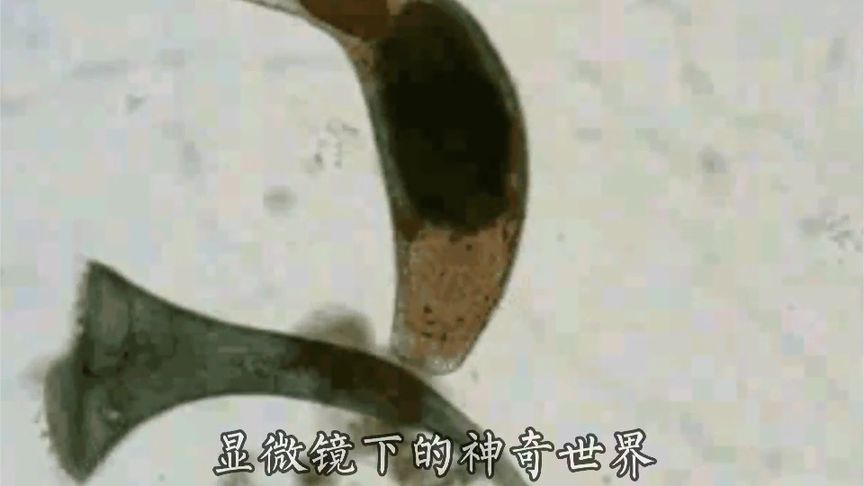 显微镜下的神奇世界