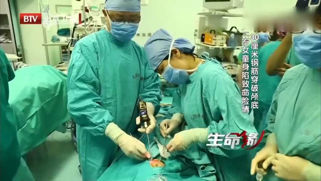 致命钢筋:钢筋在脑中情况不明,主刀医生的判断就显得尤为重要