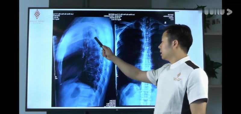 三讲:脊椎X光片影像分析胸椎、腰椎阅片
