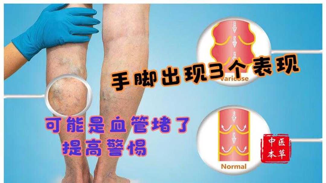 手脚出现3种变化,可能是血管堵塞了,最好去检查一下