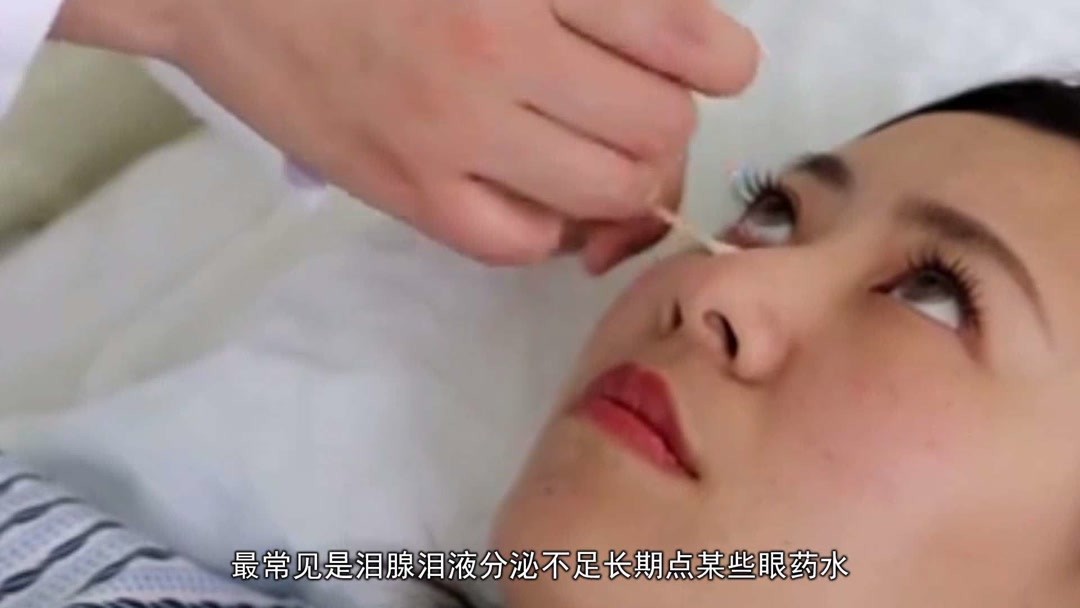 眼睛一干就滴眼药水,眼药水没那么好用,用多了还会伤害眼睛健康
