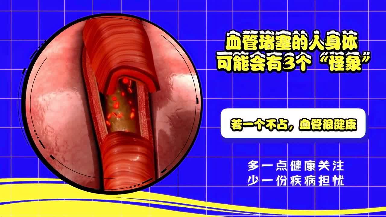 血管堵塞的人,身体可能会有3个"怪象",若一个不占血管很健康