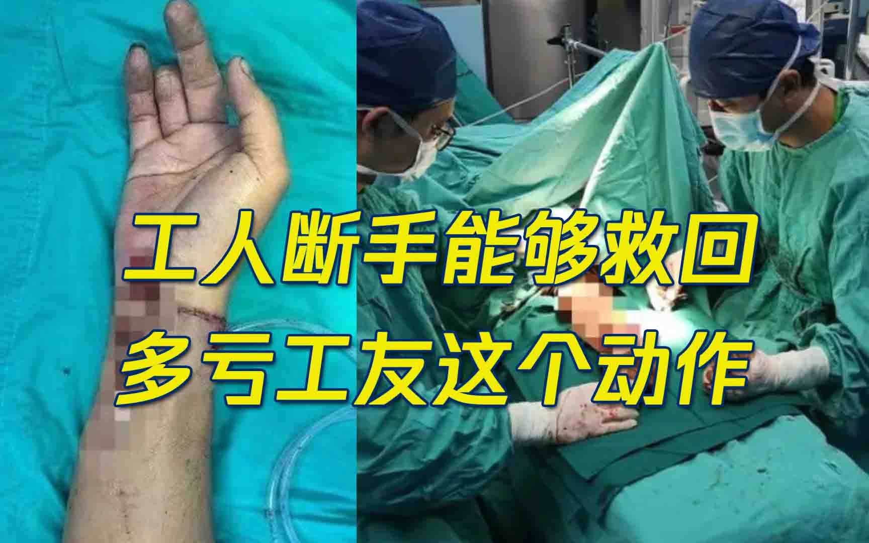 工人作业失误手被切断!做好这两点能提高接回机会!