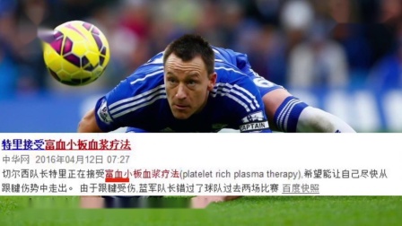 PRP富血小板血浆