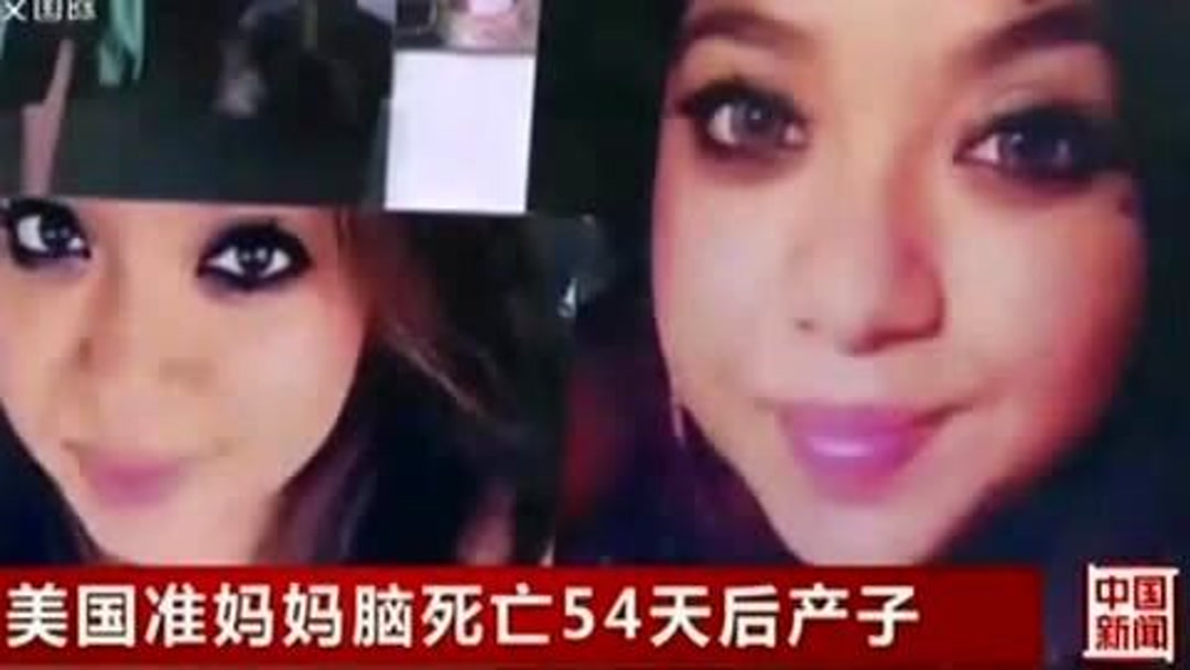 美国怀孕准妈妈突发脑溢血 脑死亡54天后顺利产子