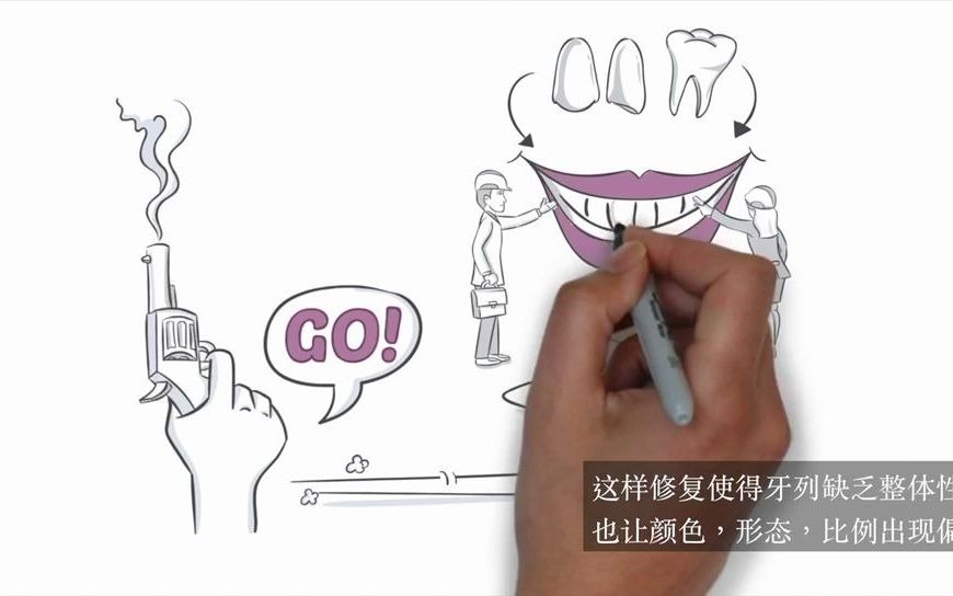 大家现在常常听到牙医说的新名词 “DSD“ 数字化微笑设计到底是...