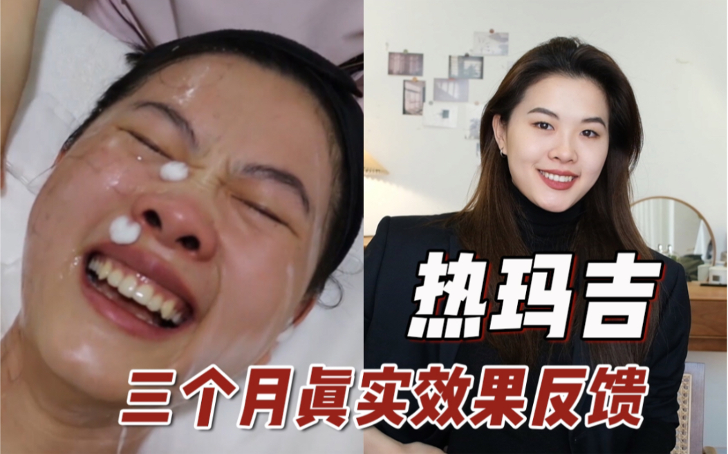 三个月热玛吉真实效果反馈!2w贵妇医美真的值吗?干货心得都告诉你们~