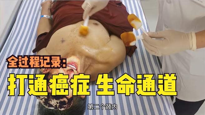 锁骨下静脉穿刺置管全过程记录:癌症病人,打开生命的快速通道!