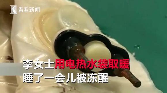 女子抱着电热水袋睡觉,谁知突然爆炸被烫伤,剪开发现这一幕