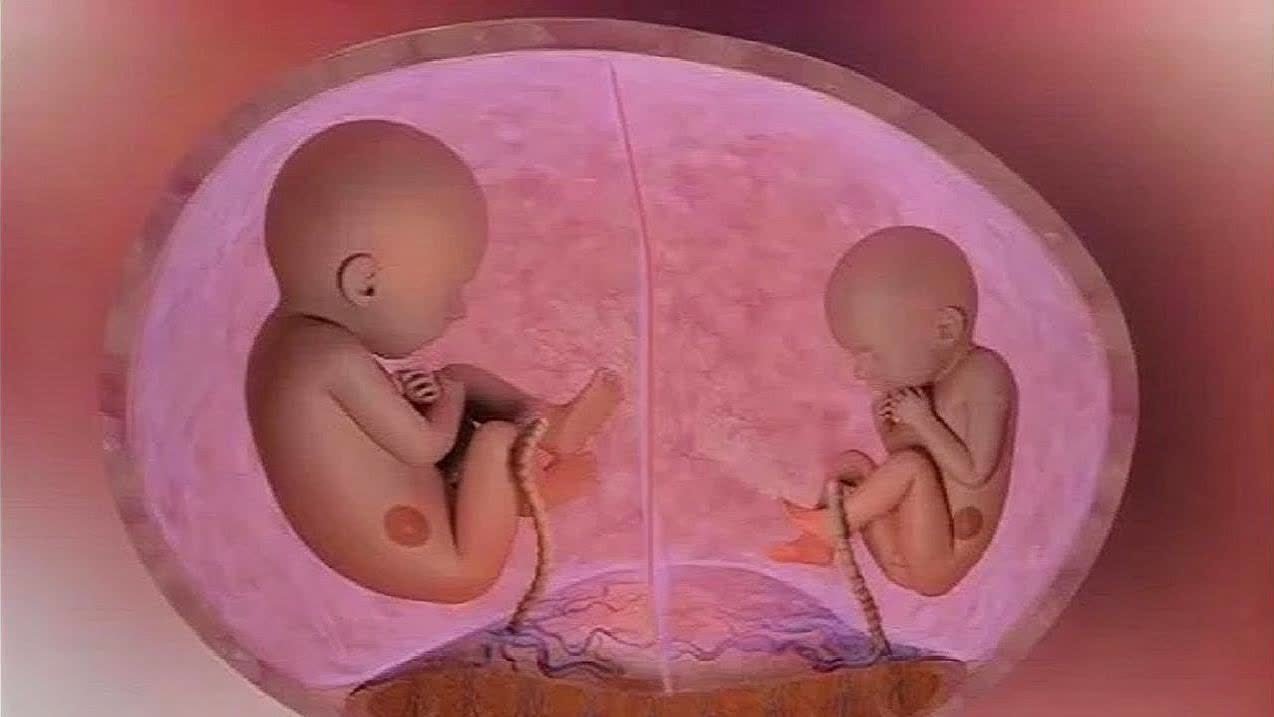 双胞胎在妈妈肚子里会干嘛?3D动画演示全过程,婴儿:别乱动!