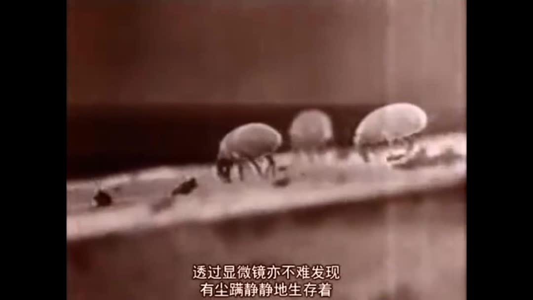 用高倍显微镜观察我们的皮肤,你能想到会看到哪些生物吗?