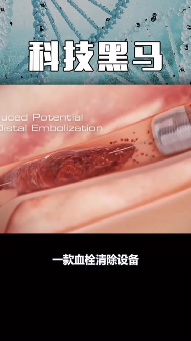 黑科技希望这样的医疗设备赶紧上线