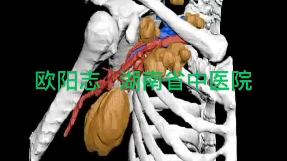 3D打印技术动画,我湖南省中医院用于治疗乳腺癌患者,制定方案