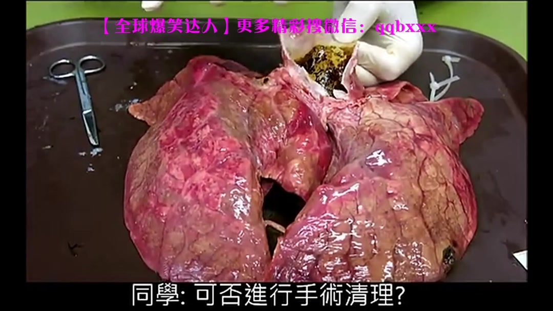 你抽的不但是寂寞,还有,你的生命!看视频了解吸烟危害实验。.