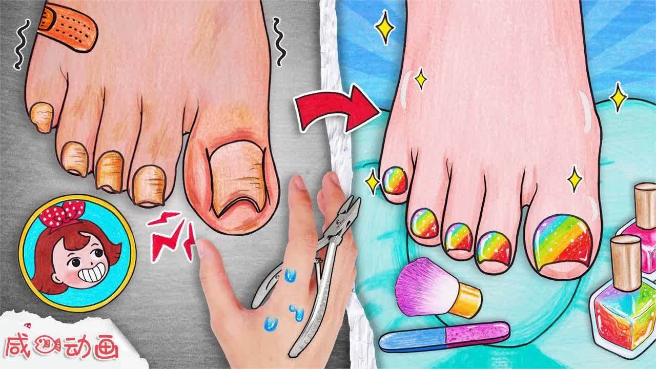 定格动画:大大帮助小美治疗脚伤,还帮她设计了一款超时尚美甲!