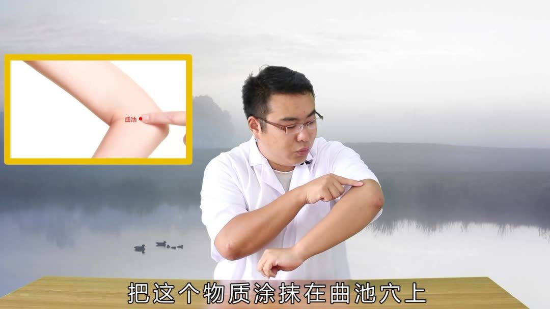 荨麻疹发作瘙痒难耐?瘾疹穴位曲池穴,有效缓解皮肤瘙痒!