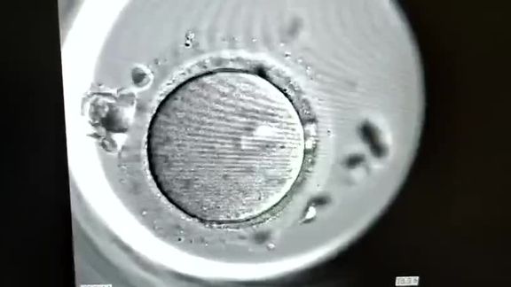 试管婴儿的受精卵发育过程