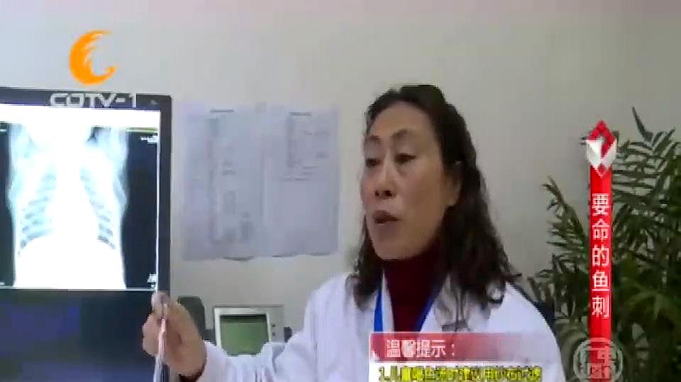 生活大揭秘:鱼刺卡喉的正确处理方式,勿吞咽其他食物,及时就医