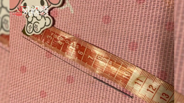 针灸漏拔针!台湾女子腰臀之间卡11公分针