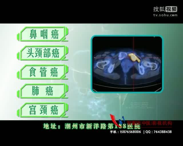 医院宣传片拍摄 医疗专题片制作 肿瘤短片剪辑 视频编辑