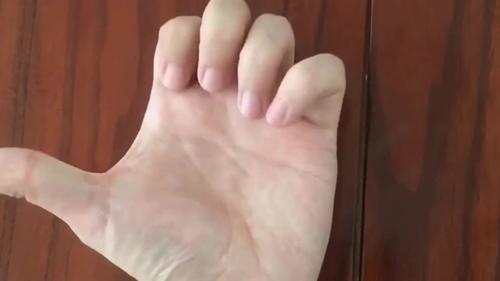 想知道自己的血管有没有堵塞吗?做一个小动作检测一下吧,挺有意思