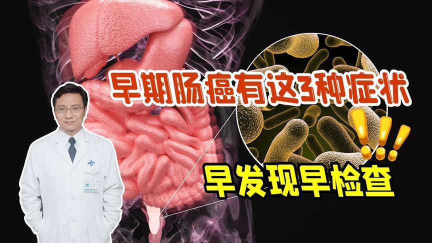 肠镜是筛查肠癌的"金标准",出现这3种症状的人,最好别放过