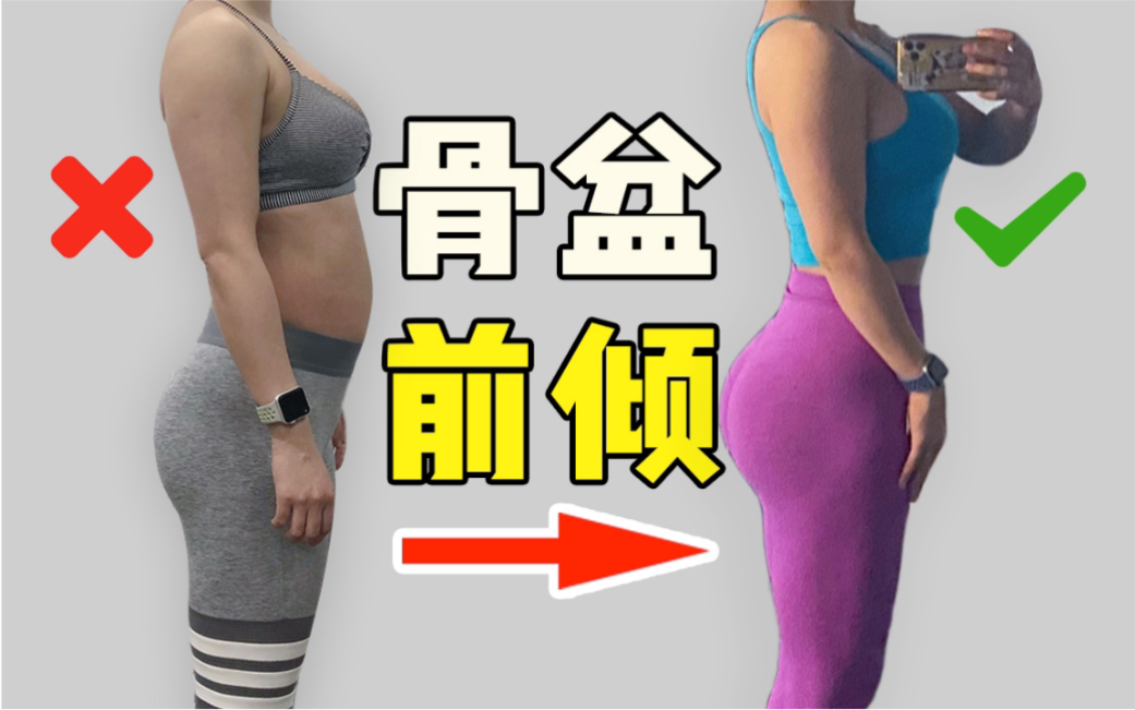 真实记录70天24次训练,我成功纠正了骨盆前倾,臀也翘了。(含自测及...