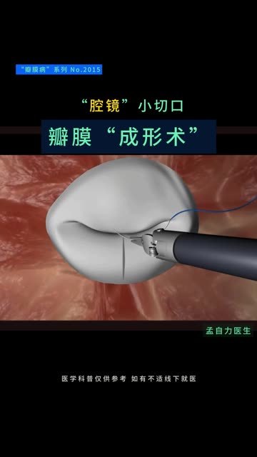 ...孟自力(O3x9yq2976f8rp62) #心脏瓣膜 #心瓣膜病 #快手光合计划助手