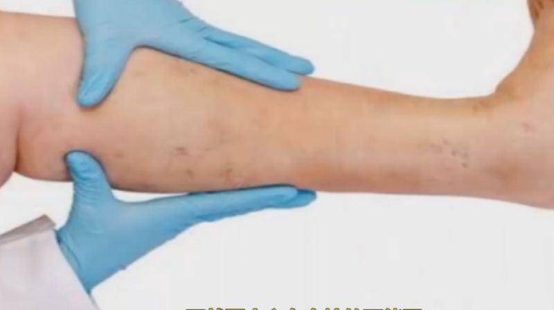 血管堵塞不要慌,先看看小腿有没有这几个特征,有就危险了!