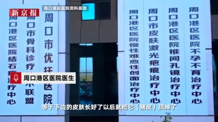 医院回应“猪躺手术台剥皮移植”: 覆盖烧伤病人皮肤再生后猪皮脱落