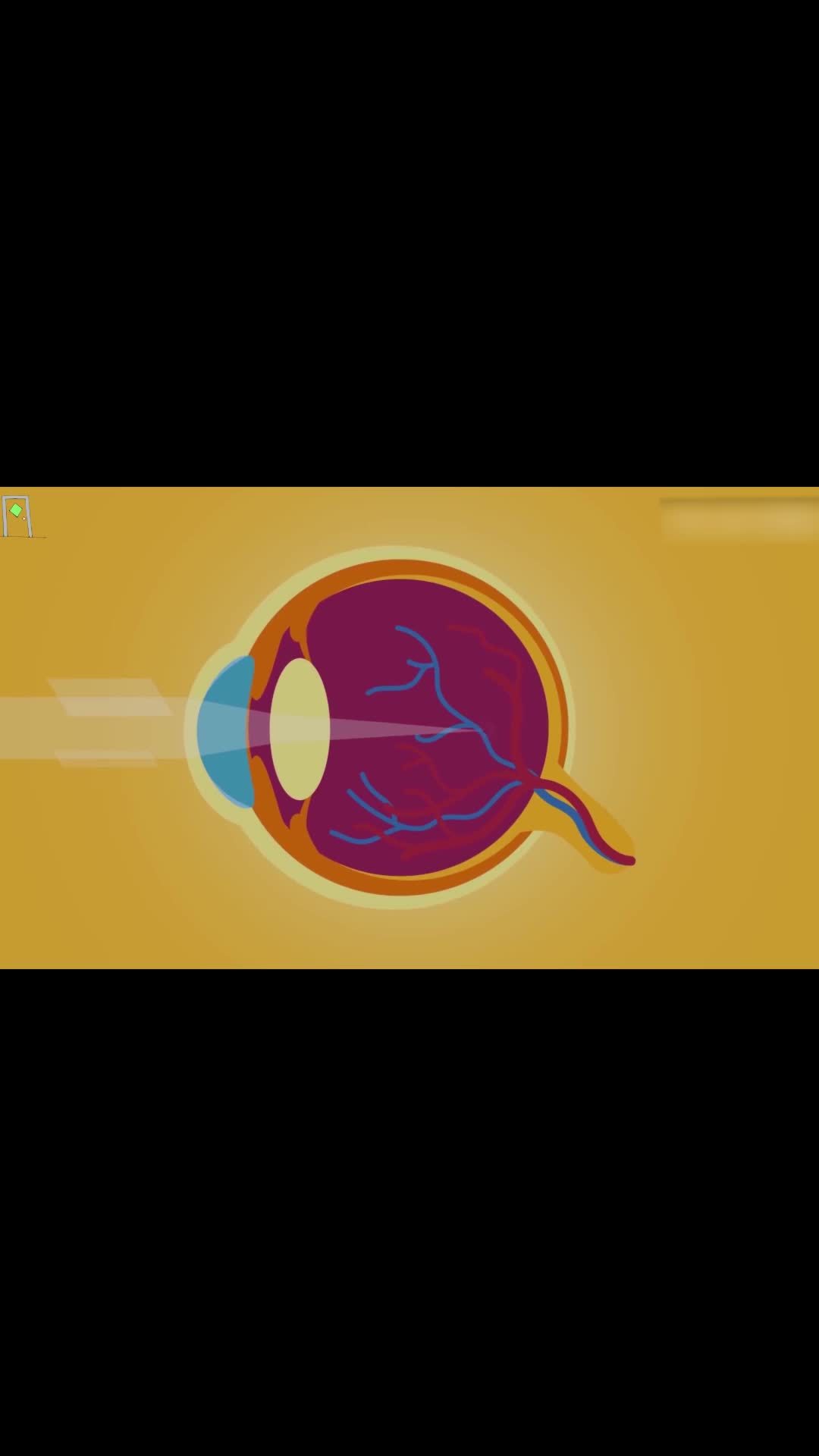 近视的人长期不戴眼镜会怎么样?