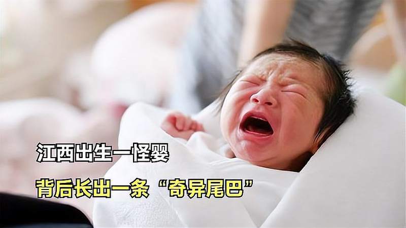 江西出生一怪婴,背后长了一条“奇异尾巴”,父母看到后流下眼泪