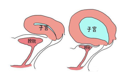 3D动画演示,女人经常憋尿,会带来什么严重后果?看完再也不敢了
