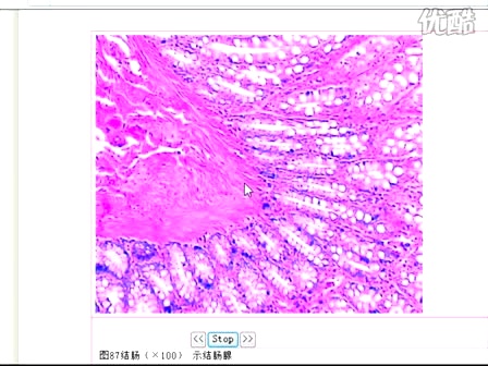 组织学切片