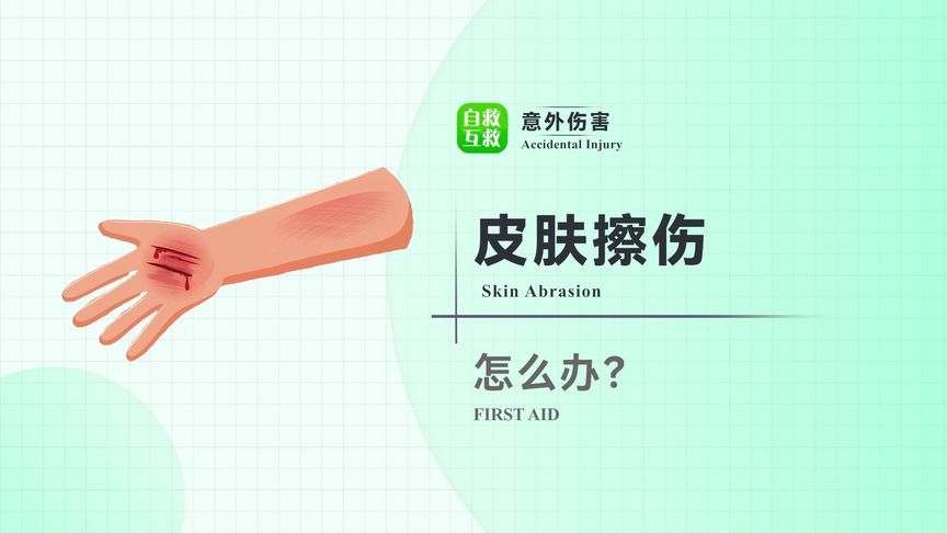 皮肤擦伤怎么好得快?医生教你如何正确处理