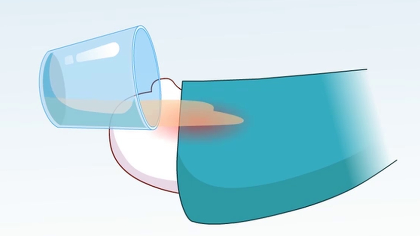 被热水烫着了怎么办