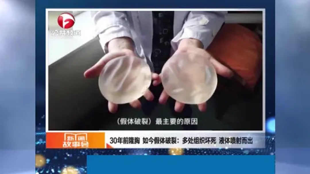 30年前做隆胸手术,六十岁女子假体破裂,多处组织坏死