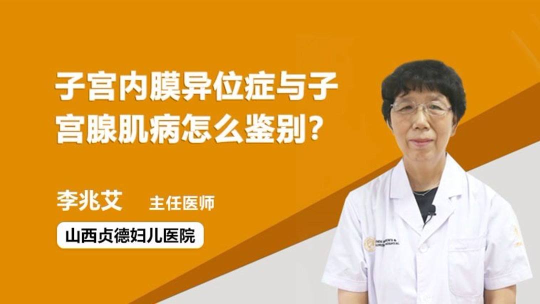 子宫内膜异位症与子宫腺肌病怎么鉴别?