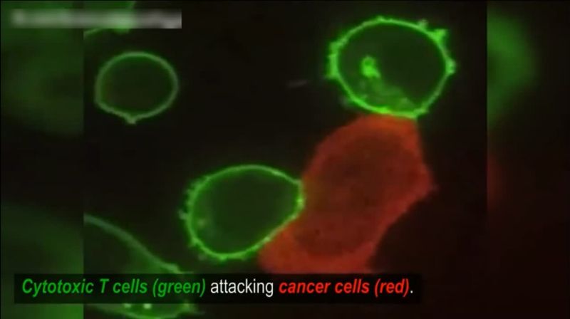   显微镜下看人体细胞杀死癌细胞、细菌、病毒,如同战争大片