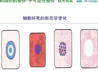 执考驿站2015年执业医师病理学-细胞、组织的适应、损伤和修复