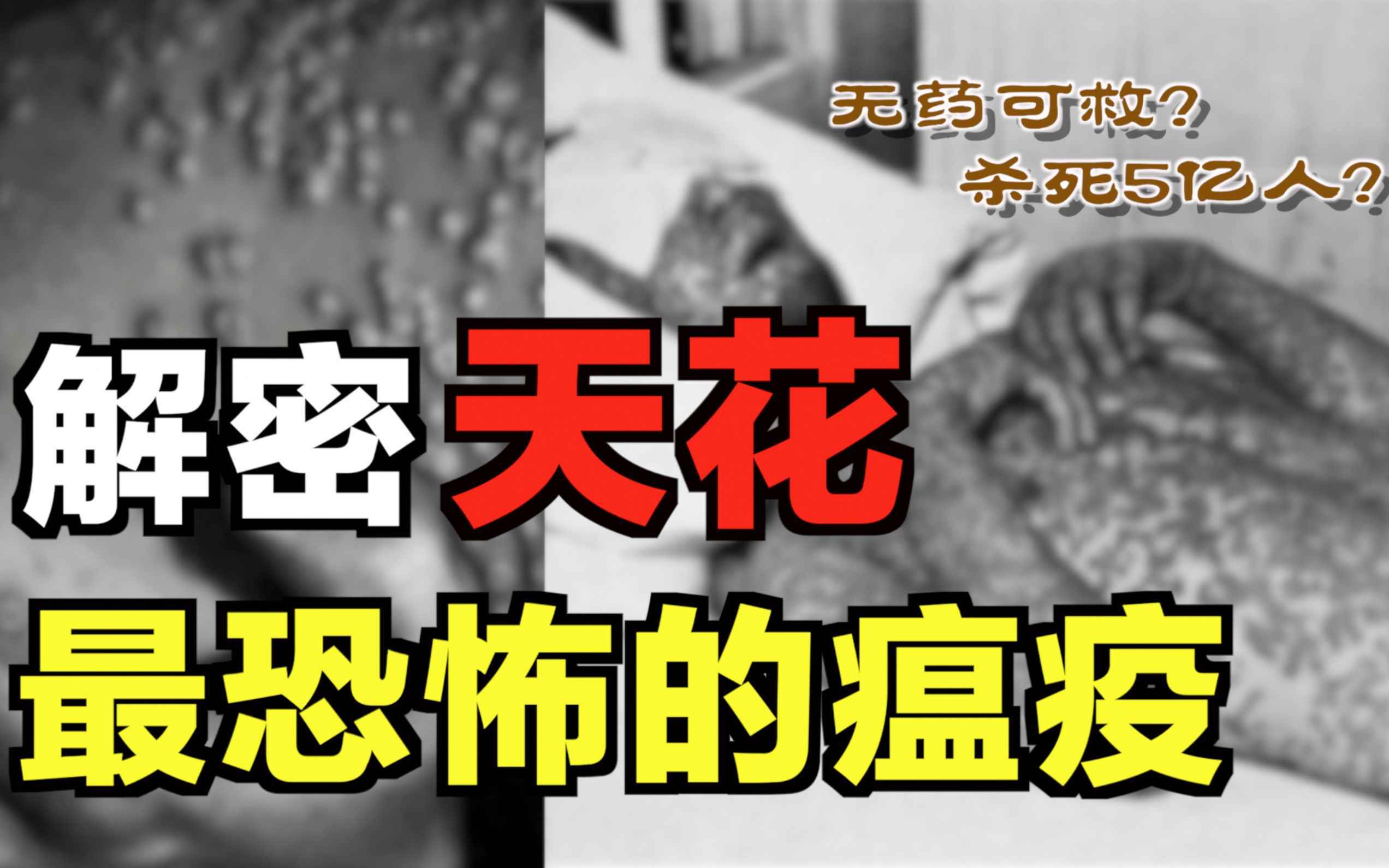 致命天花!世界排名第一的恐怖病毒疯狂肆虐,人类的第一场瘟疫战争!【...