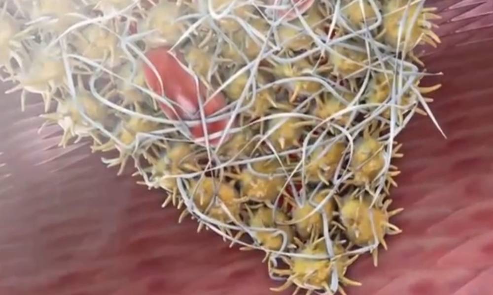 剖腹产妈妈如何快速去疤痕?几个小妙招送给你