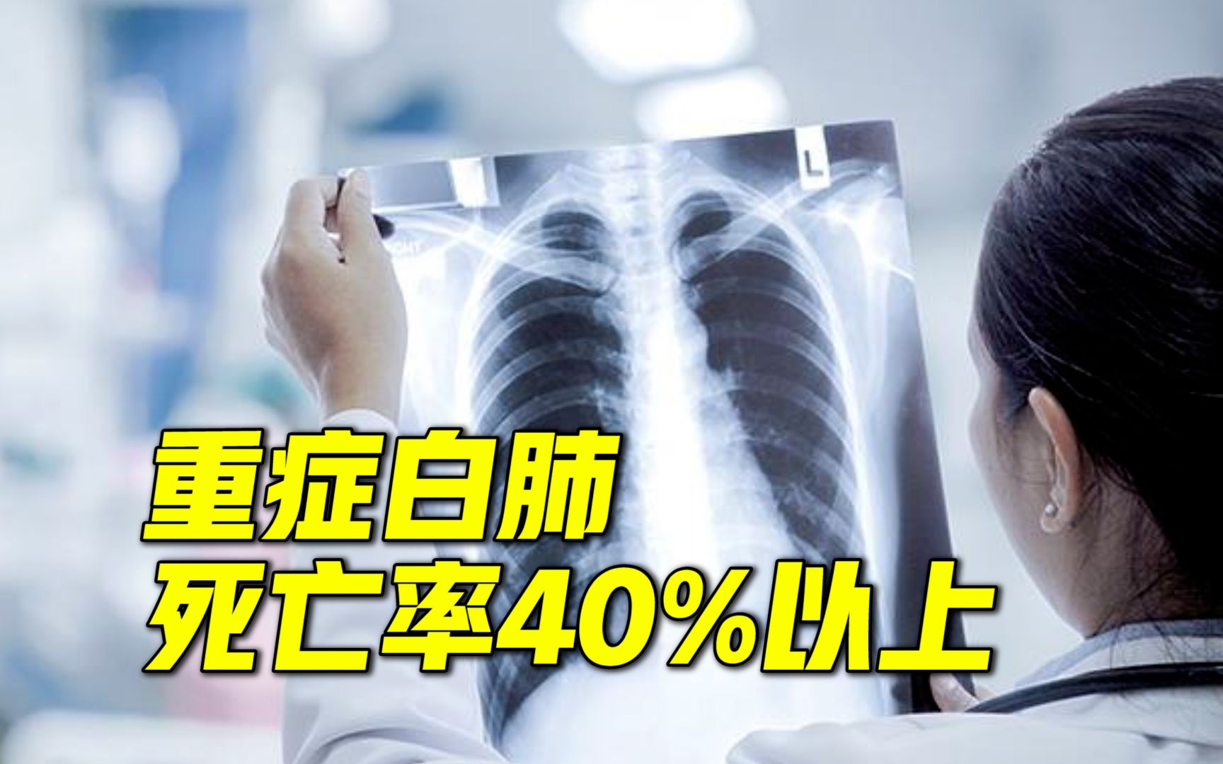 重症白肺死亡率40%以上,专家:新冠造成白肺的概率不是很高