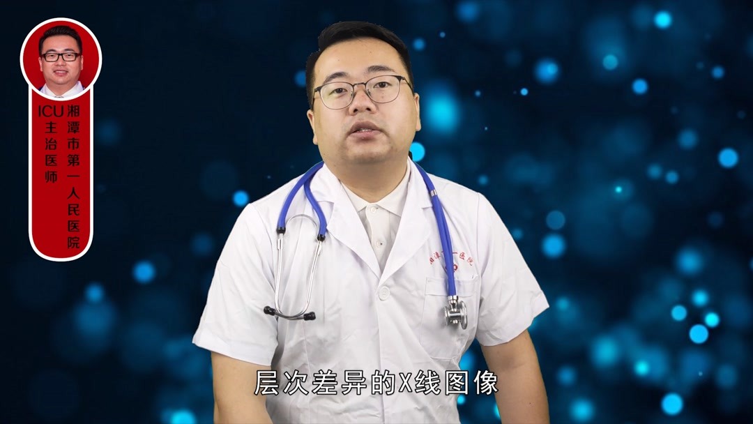 X线成像的基本原理是什么?医生给出了明确答复,一次性说清楚