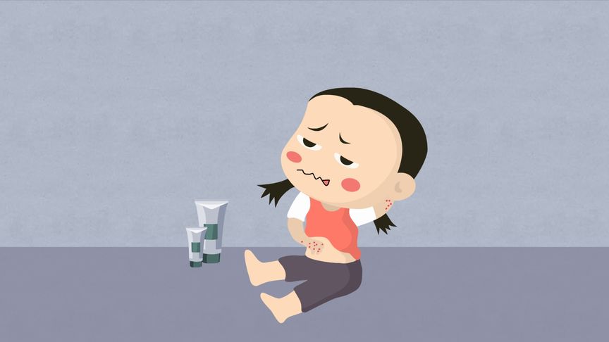 手部湿疹用什么药膏管用?