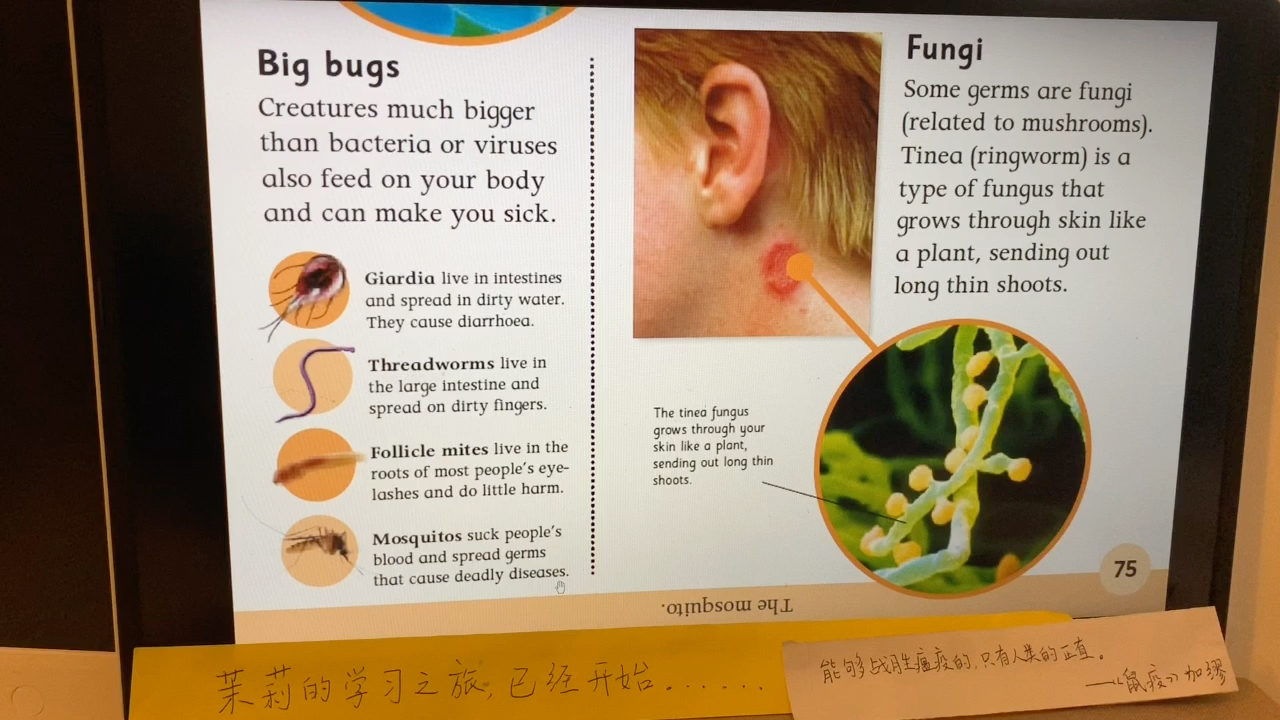 「DK人体百科」“细菌 病毒 真菌”(中)…了解一下…