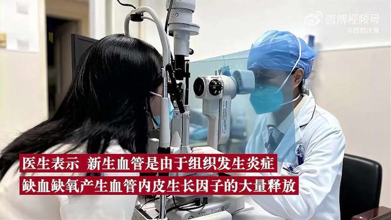 【 女子戴隐形10年角膜长满新生血管 】近日,广东深圳,90后女生小荆(...