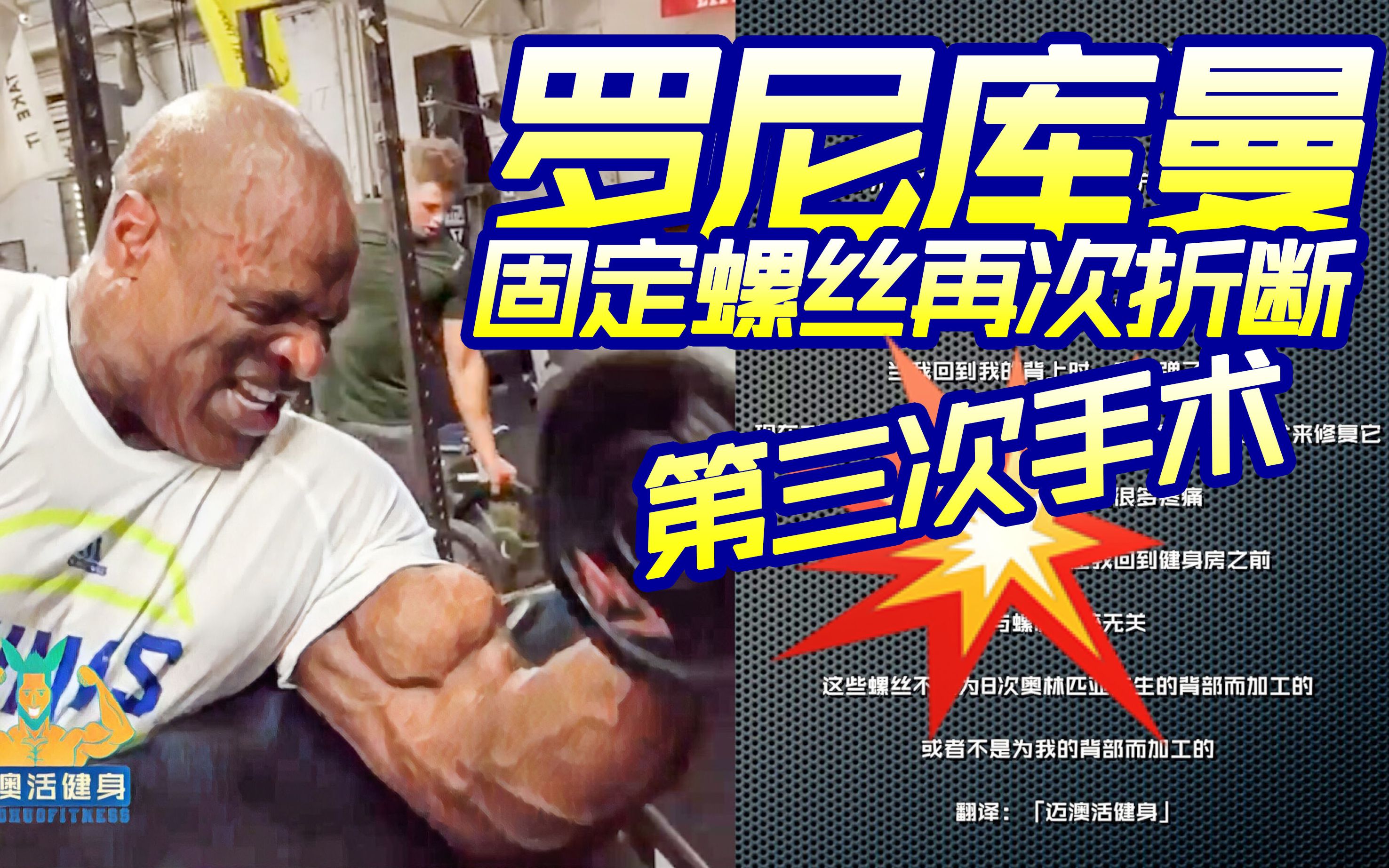 最新消息,罗尼库曼手术固定螺丝第二次折断,还需进行今年第三次手术,...