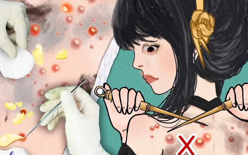 沉浸式美妆,痤疮,背部痤疮! 如何摆脱背部痤疮!定格动画~