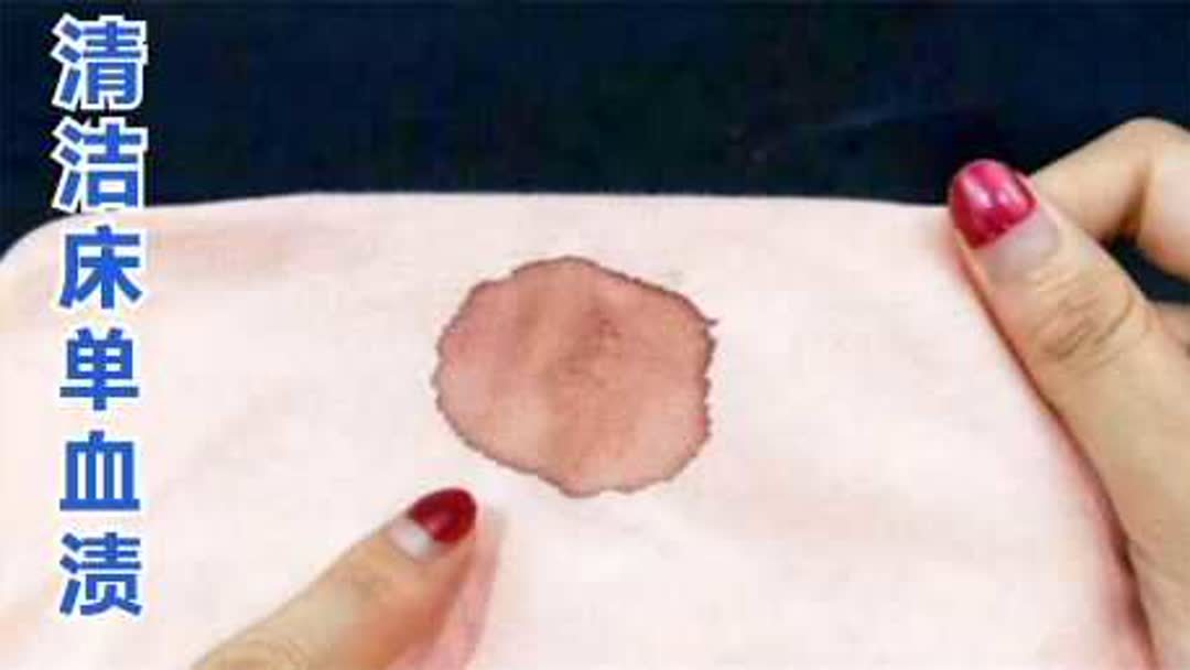 床单沾上血渍不用愁,一个简单方法,新旧血渍轻松去除,方法真棒